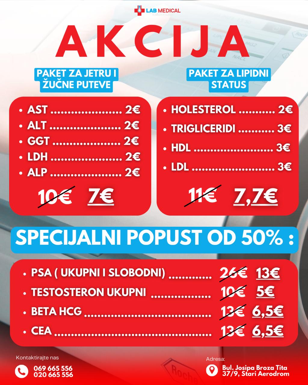 Specijalna akcijska ponuda – Popusti na laboratorijske analize! - Lab ...